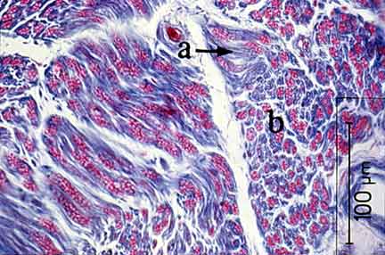 Nervous Tissue Examples